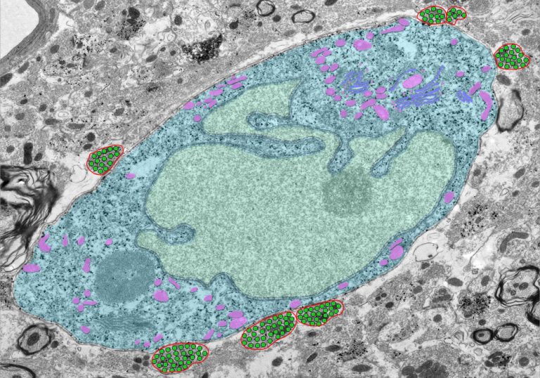 National Institute on Drug Abuse IRP - Electron Microscopy Core