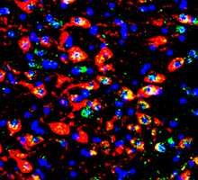Brain CB2 receptor: a new target in medication development for treating ...